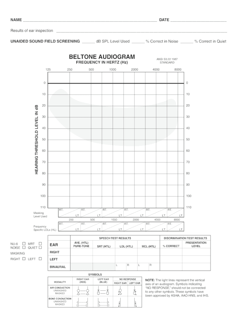 Printable Audiogram Template – Fill Out And Sign Printable Pdf Template ...